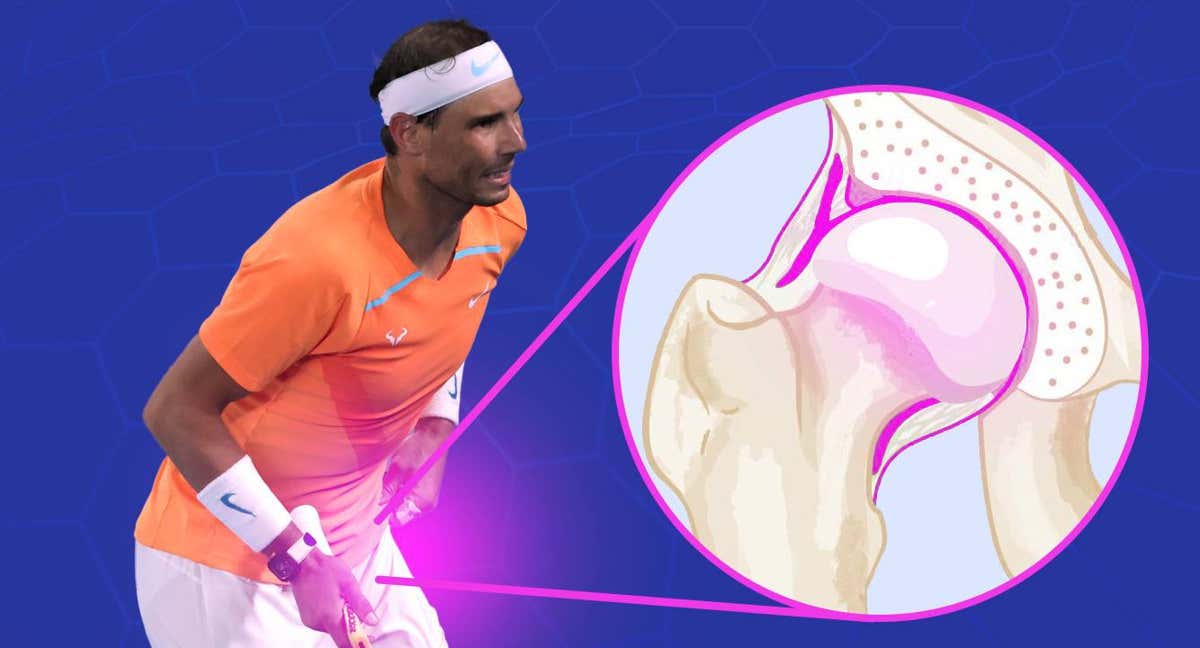 Qué es el lábrum y por qué es tan importante esa segunda operación a la ...